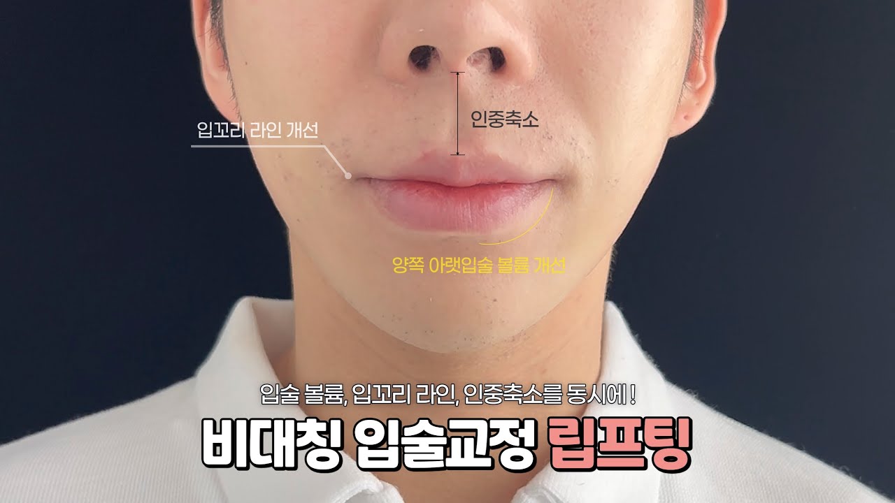 청담솔루션의원 립프팅