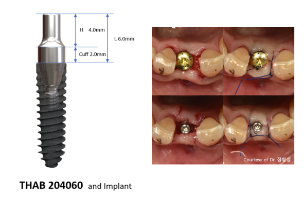 THAB Gide Set : 알파베러