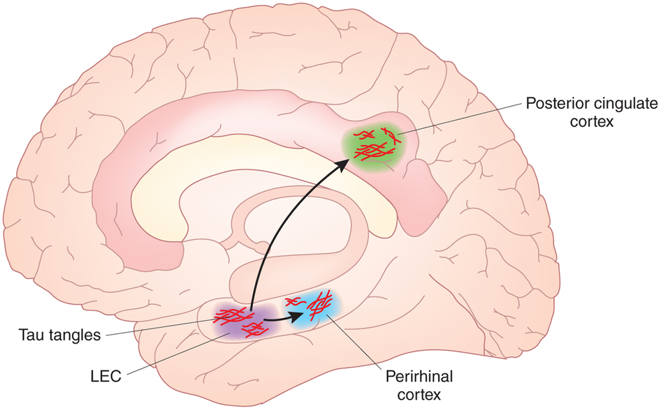 Ground zero in Alzheimer's disease ("Molecular drivers and cortical spread of lateral entorhinal ...