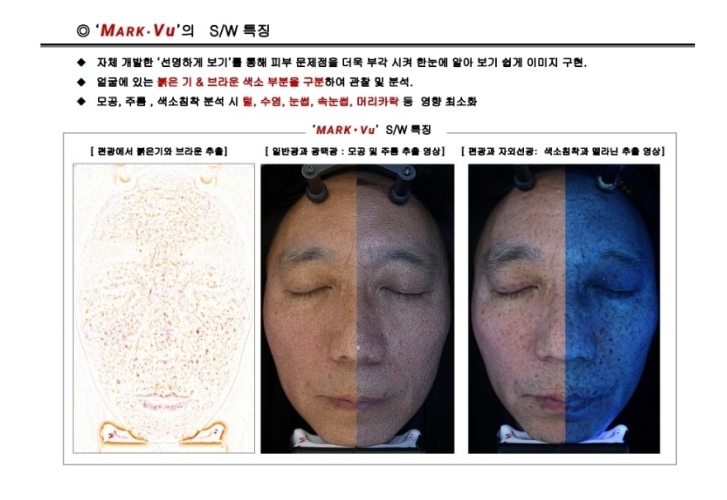 [닥터스앱] 마크뷰(Mark-vu)