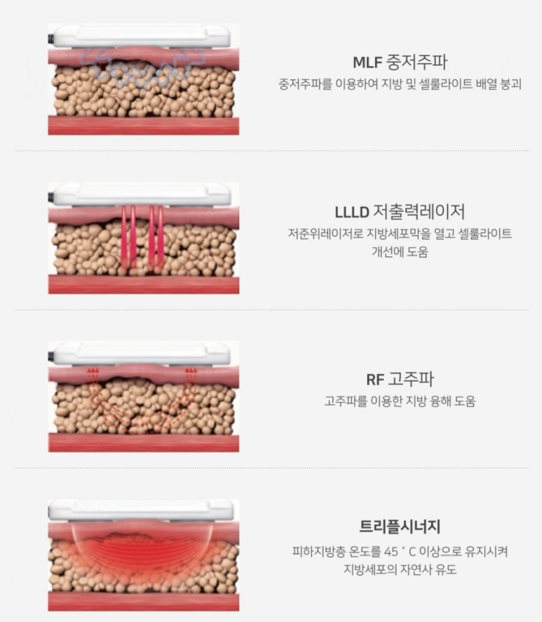 [닥터스앱] 트리플바디(TRIPLE BODY)