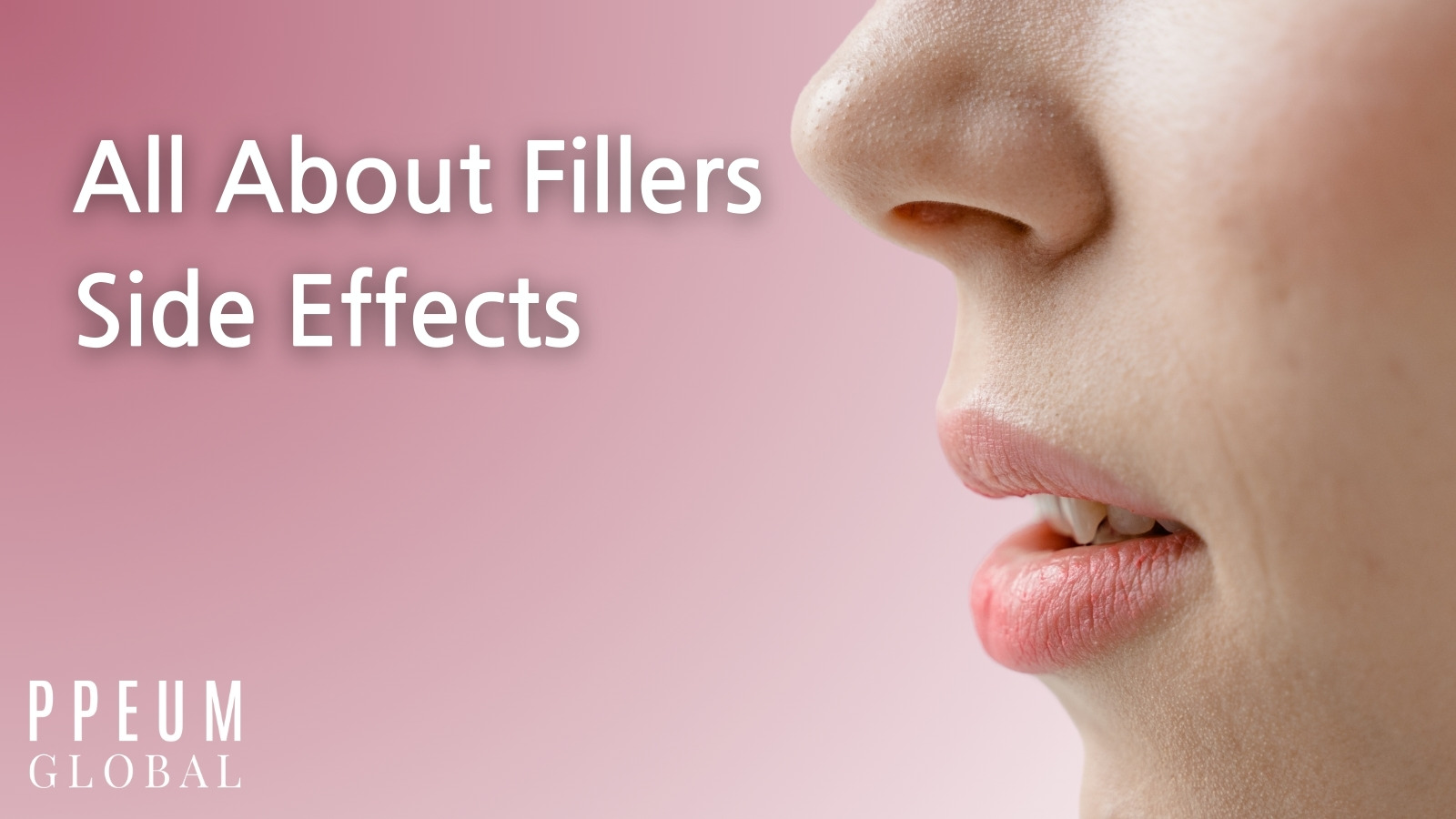 Side Effects of Dermal Fillers Explained by Dermatology | PPEUM : PPEUM ...
