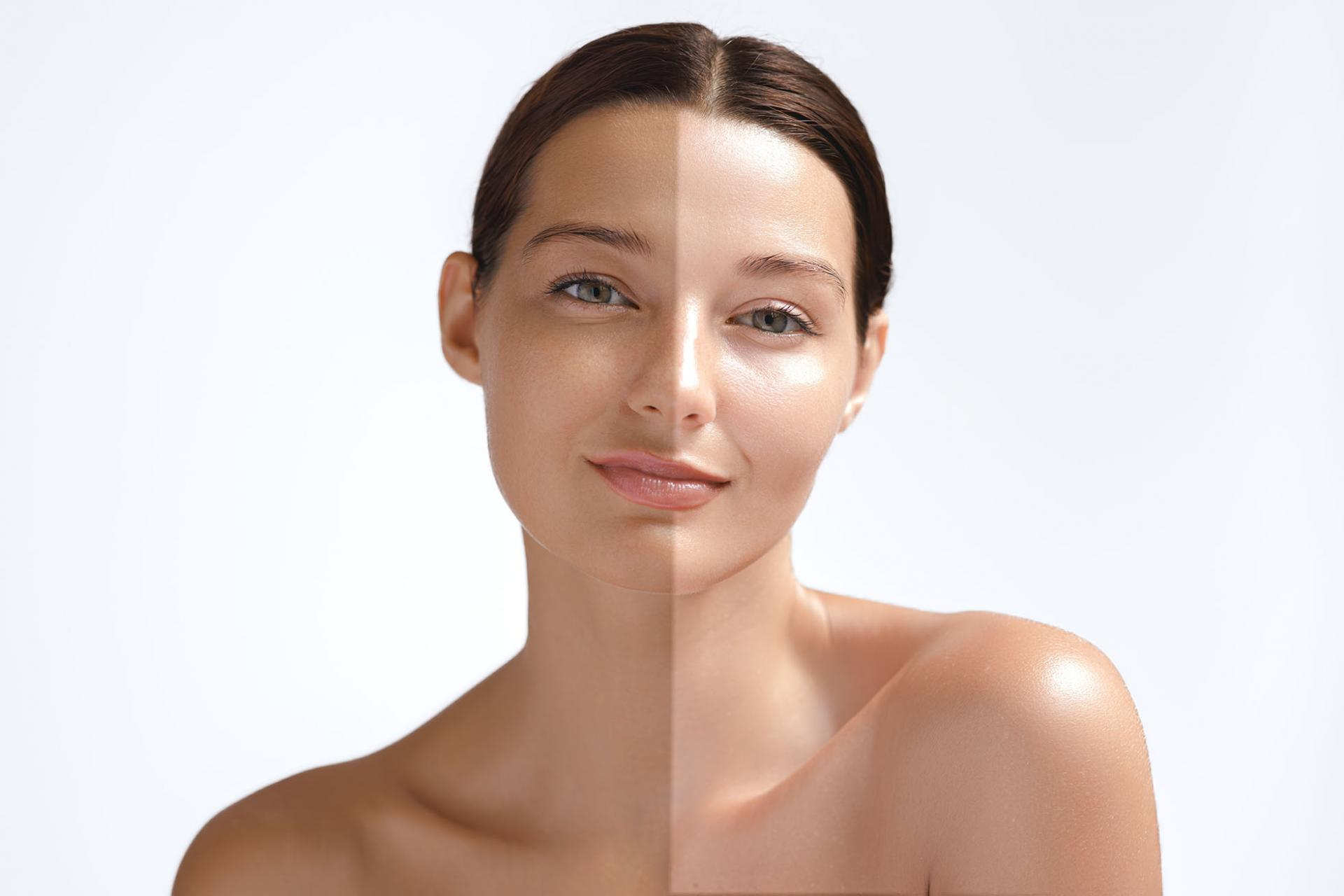 Spicule Effects by Skin Type | Customized Skin Science Solutions